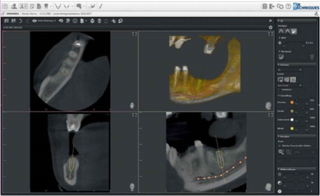 Air Techniques ProVecta 3D Prime CBCT | WDA Equipment Solutions